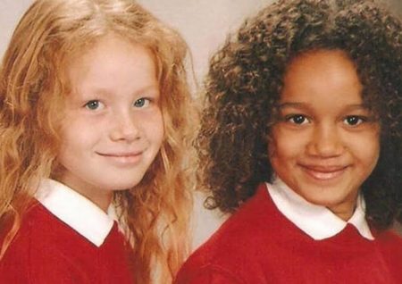 Remember these rare twins with different skin colors? This is how they ...